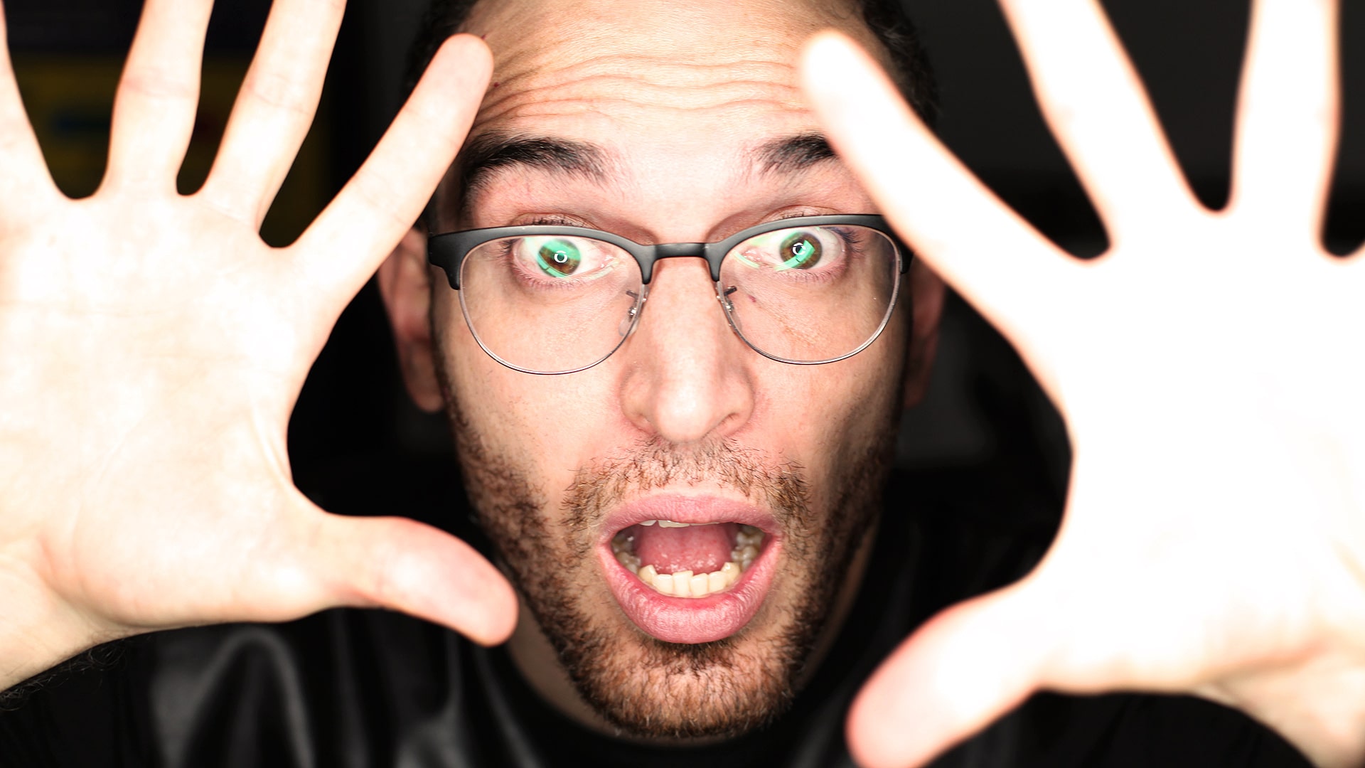 Las 40 de Lazo con Alain Gómez Eps. 77