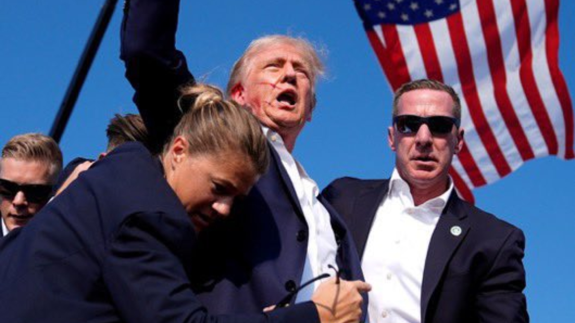 Doctor afirma que herida en la oreja de Trump evoluciona "favorablemente"